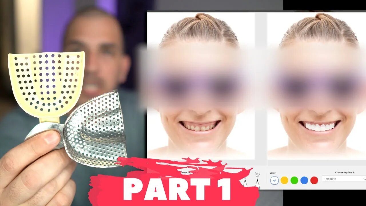 Porcelain Veneers Procedure Digital Design App To Visualize Smile