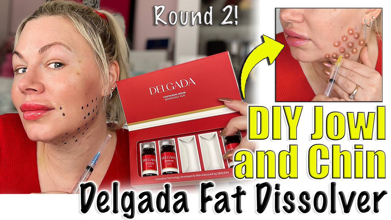 DIY Jowl and Chin Fat Dissolving with Delgada, Maypharm.net | Code ...