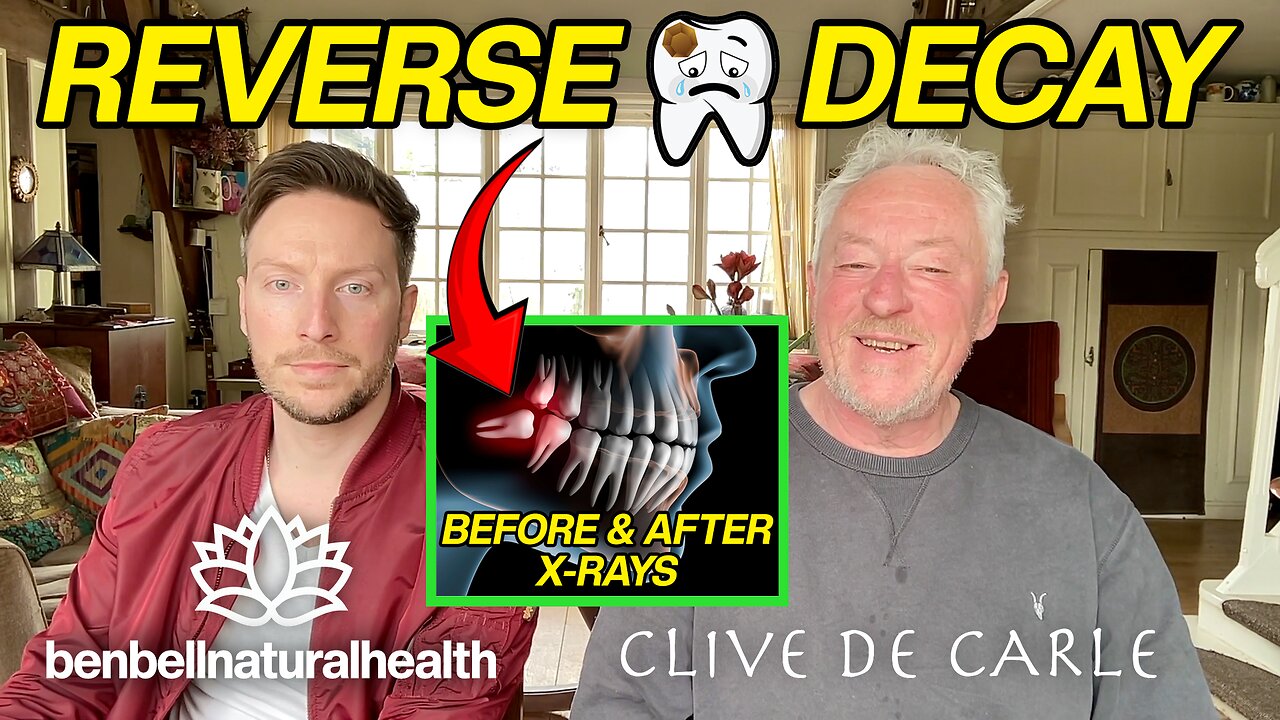 Clive de Carle with Ben Bell Natural Health | Reverse Tooth Decay ...
