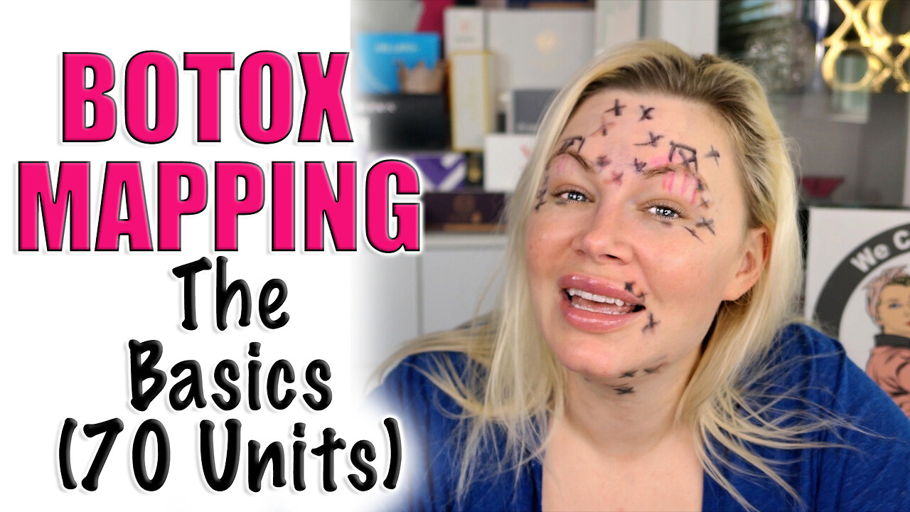 My Botox Mapping: The Basics (70 Units DIY) | Code Jessica10 saves you ...
