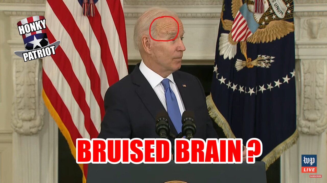JOE BIDEN HAS BIZARRE SPOT ON HEAD, GOES BLANK FOR 8 SECONDS DURING ...