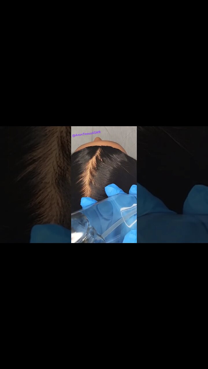 Scalp Check & Treatment ~ASMR No Talking #asmr #asmrsounds # ...