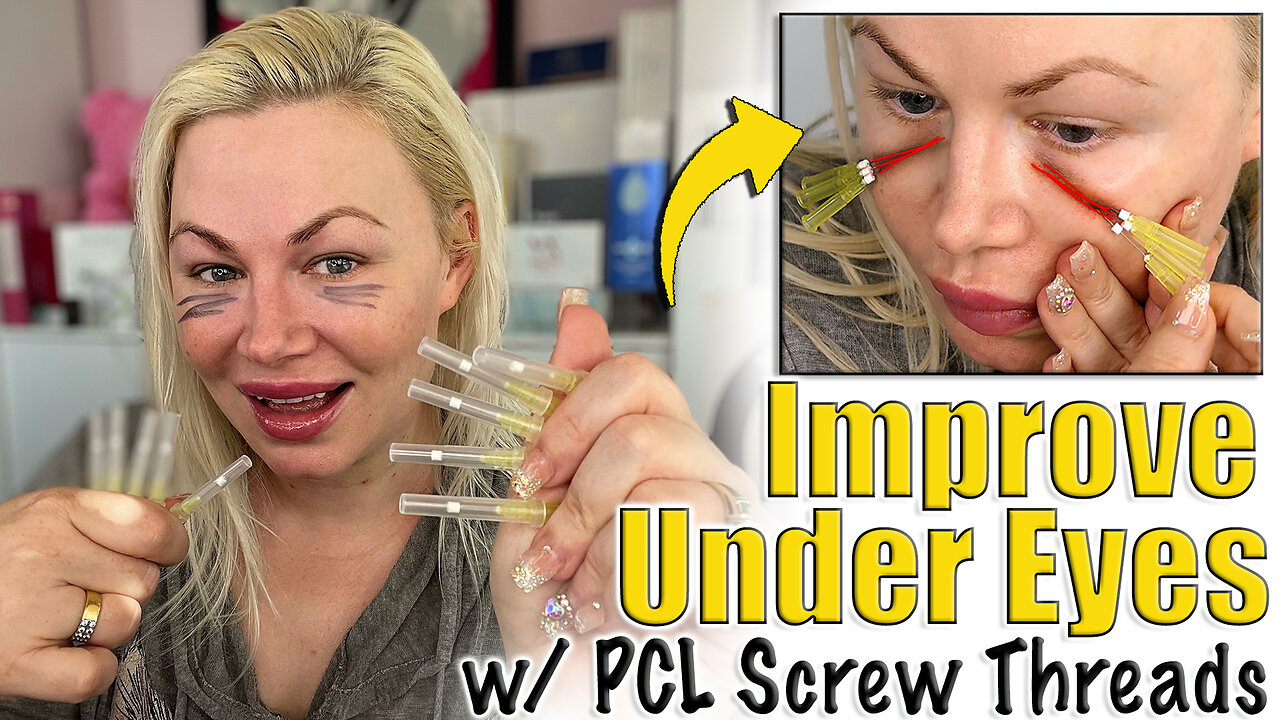 Improving Under Eyes with PCL Screw Threads, AceCosm | Code Jessica10 ...
