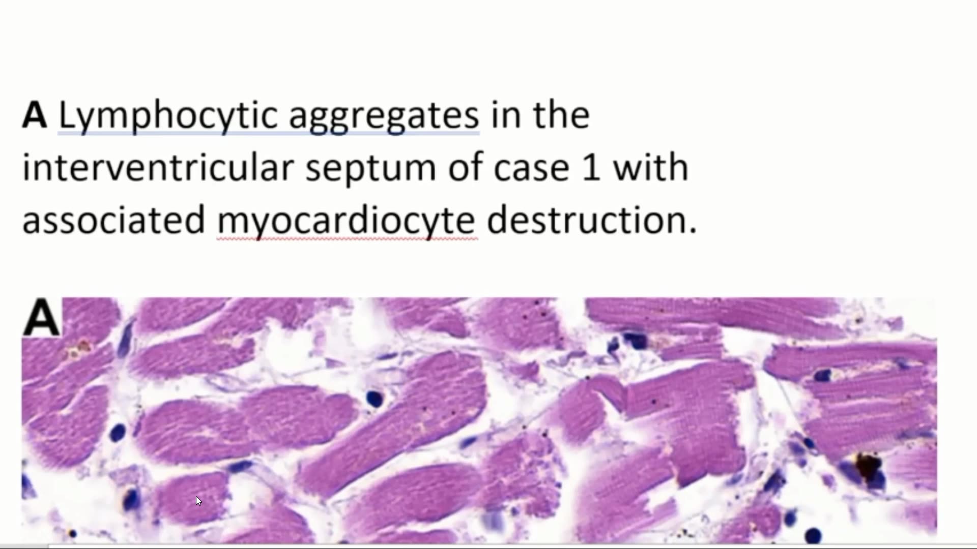 New German Autopsy report reveals those who died suddenly were killed ...