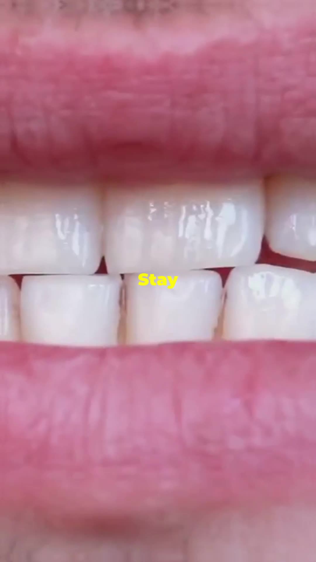 Beware! These Drinks Are Ruining Your Teeth!