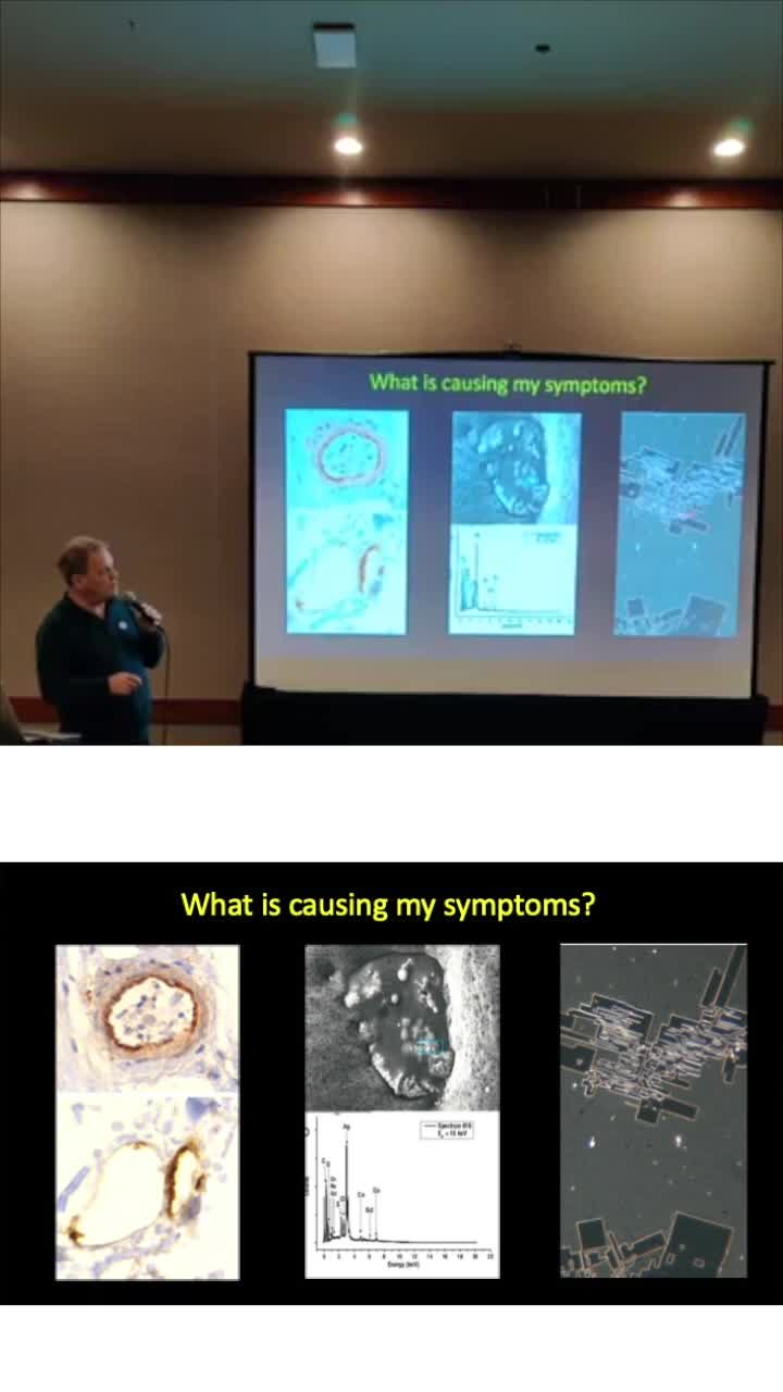 Dr. Stephen Malthouse Presentation: Justice for the Vaccinated Moving ...