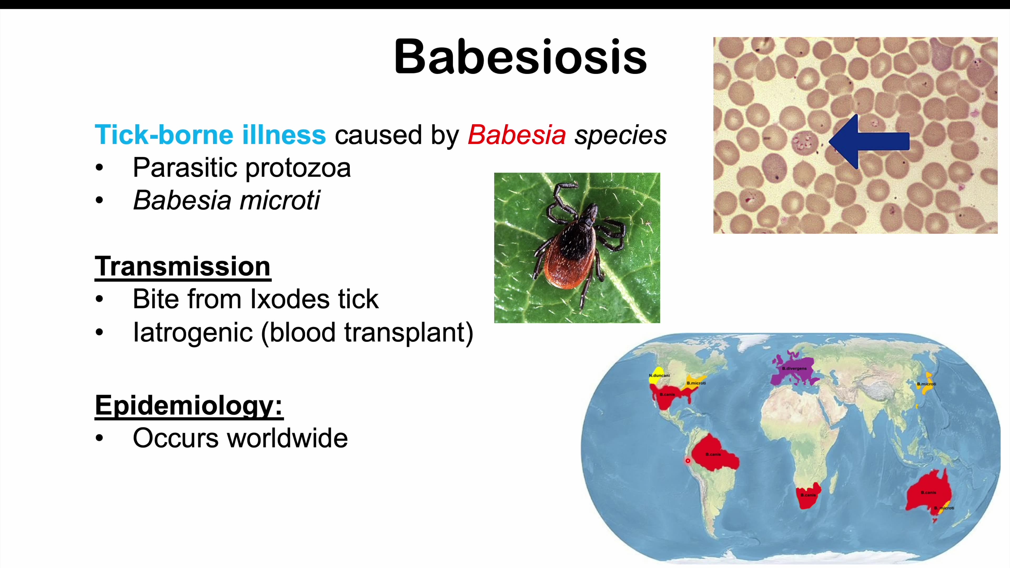 Babesiosis (Infection From Tick Bite) | Pathophysiology, Symptoms ...