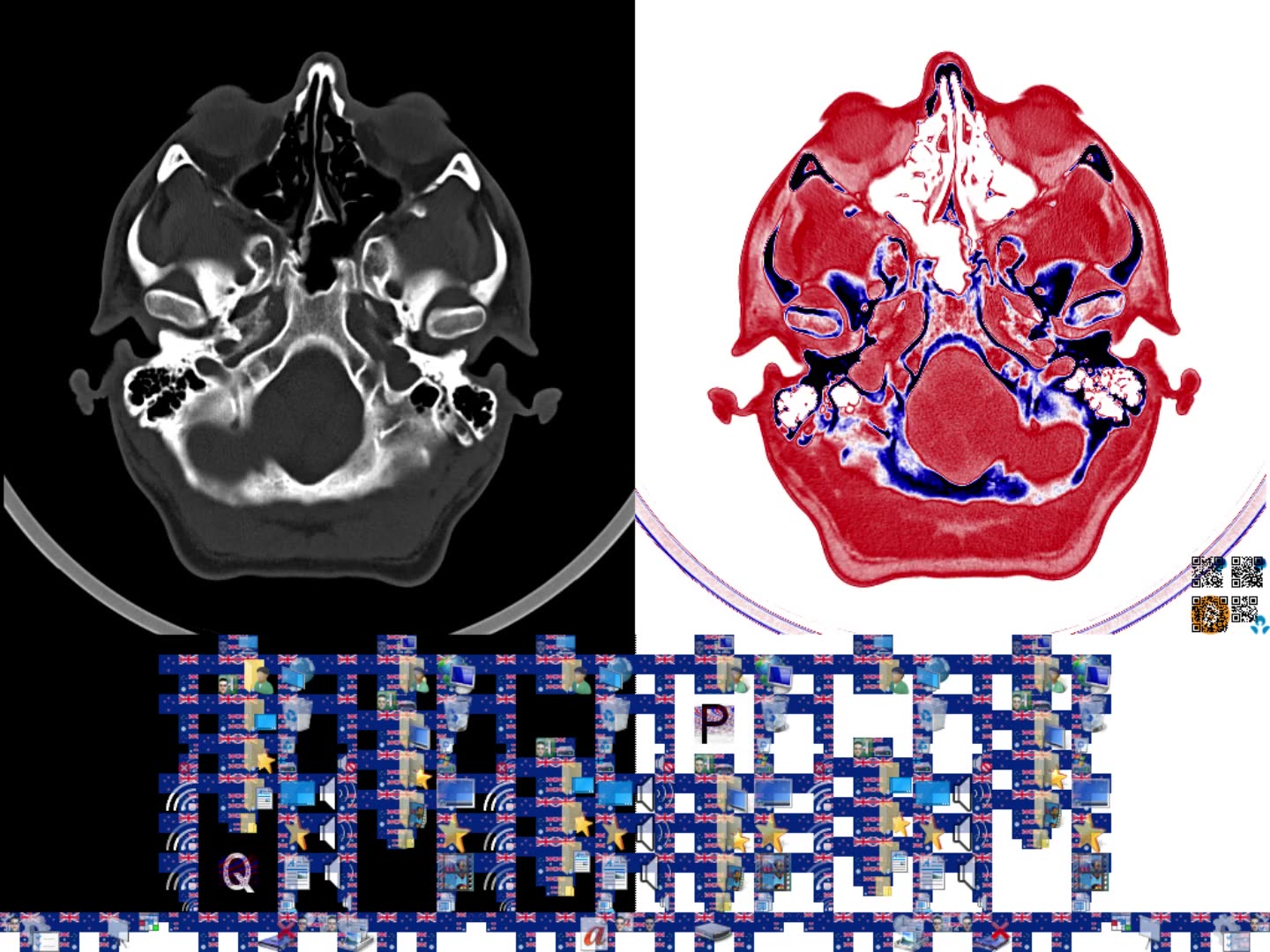 BLUE STEEL: CT Scan + ANZ flag art + Windows icons + AČE-20 Alphabet ...