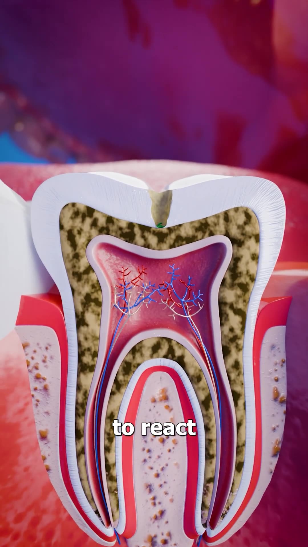 How a teeth abscess develops