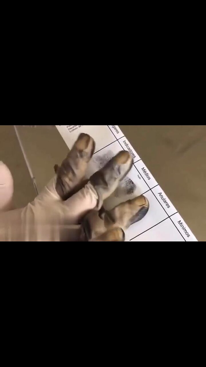 Wearing a deceased person’s hand like a glove to get their fingerprints ...