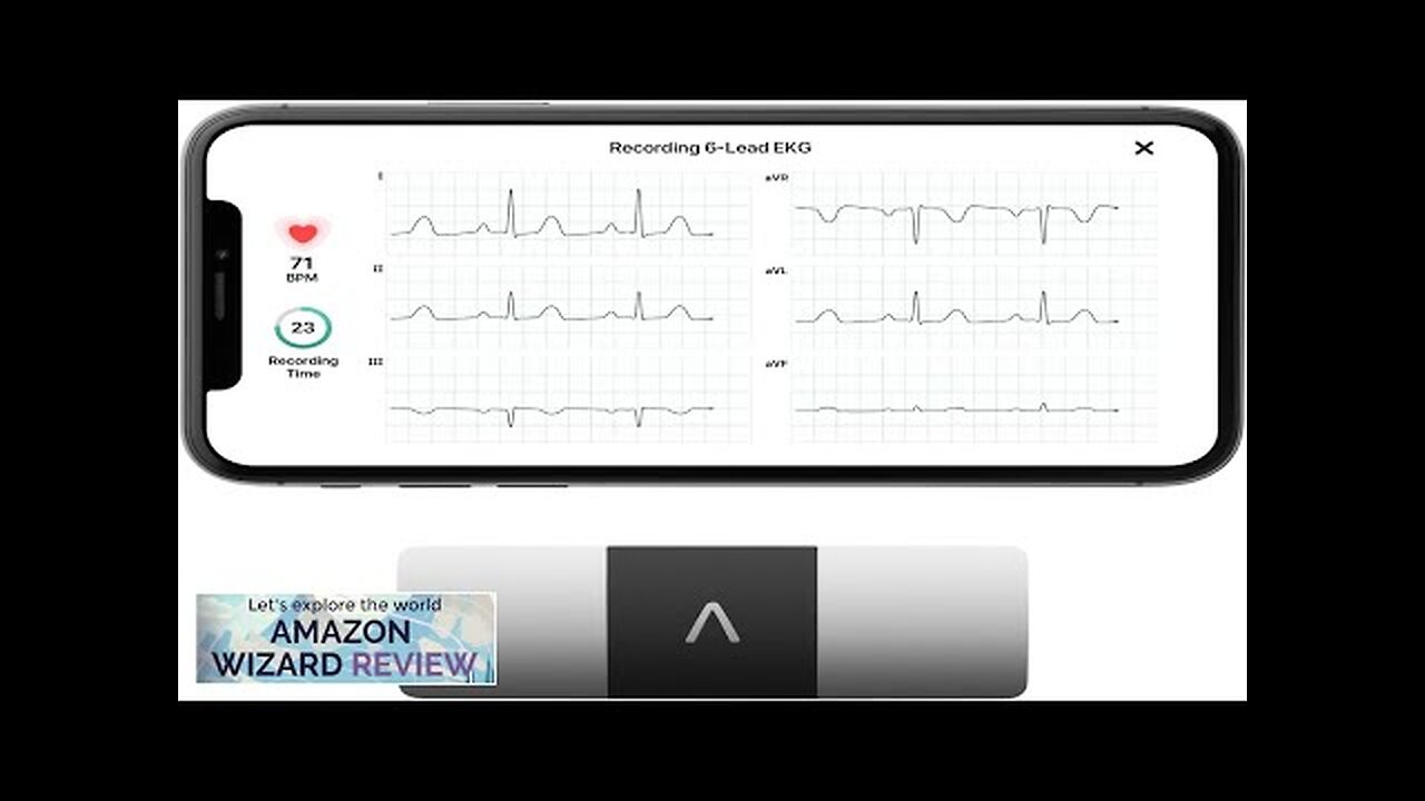 KardiaMobile 6-Lead Personal EKG Monitor – Six Views of The Heart – Review