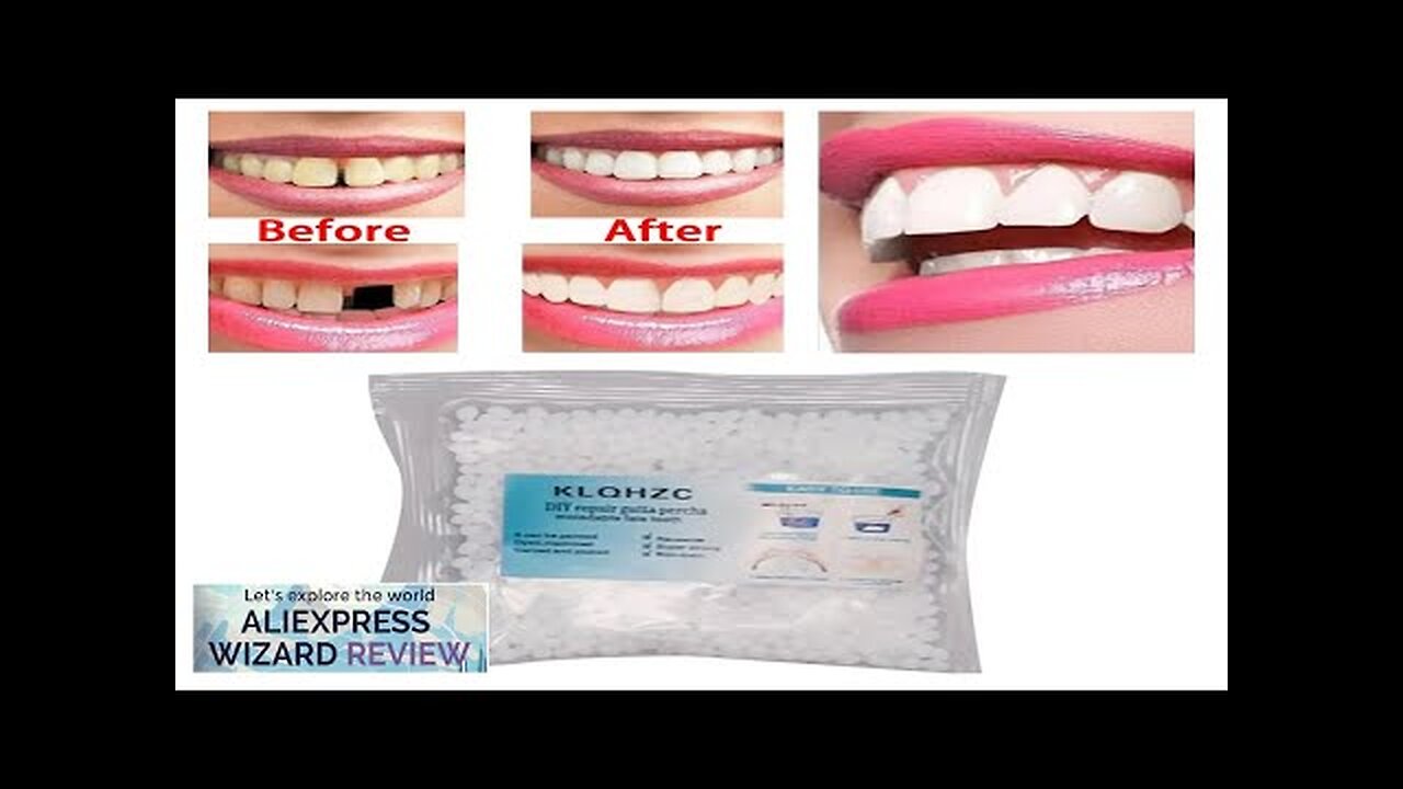Temporary Tooth Repair Kit 25G Thermal Beads Filling Fix The Missing ...
