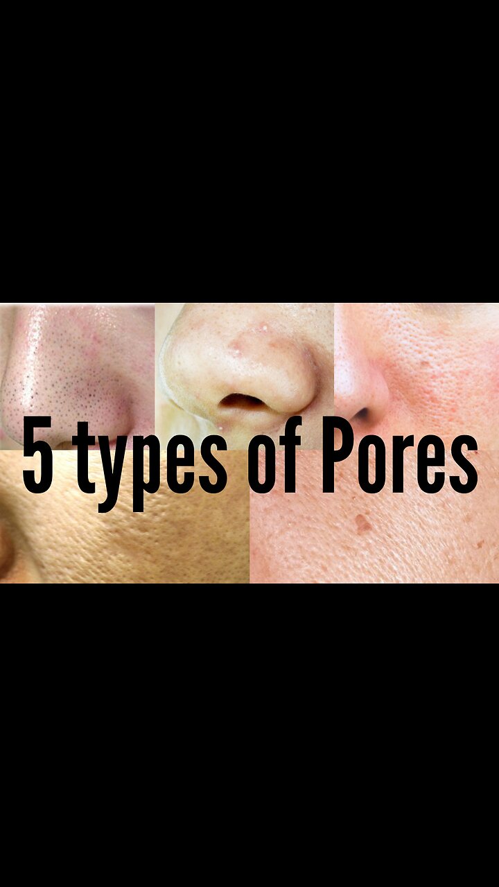 skin pore types