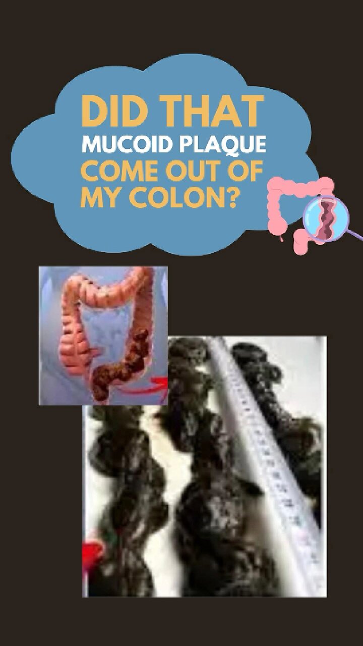 Mucoid Plaque
