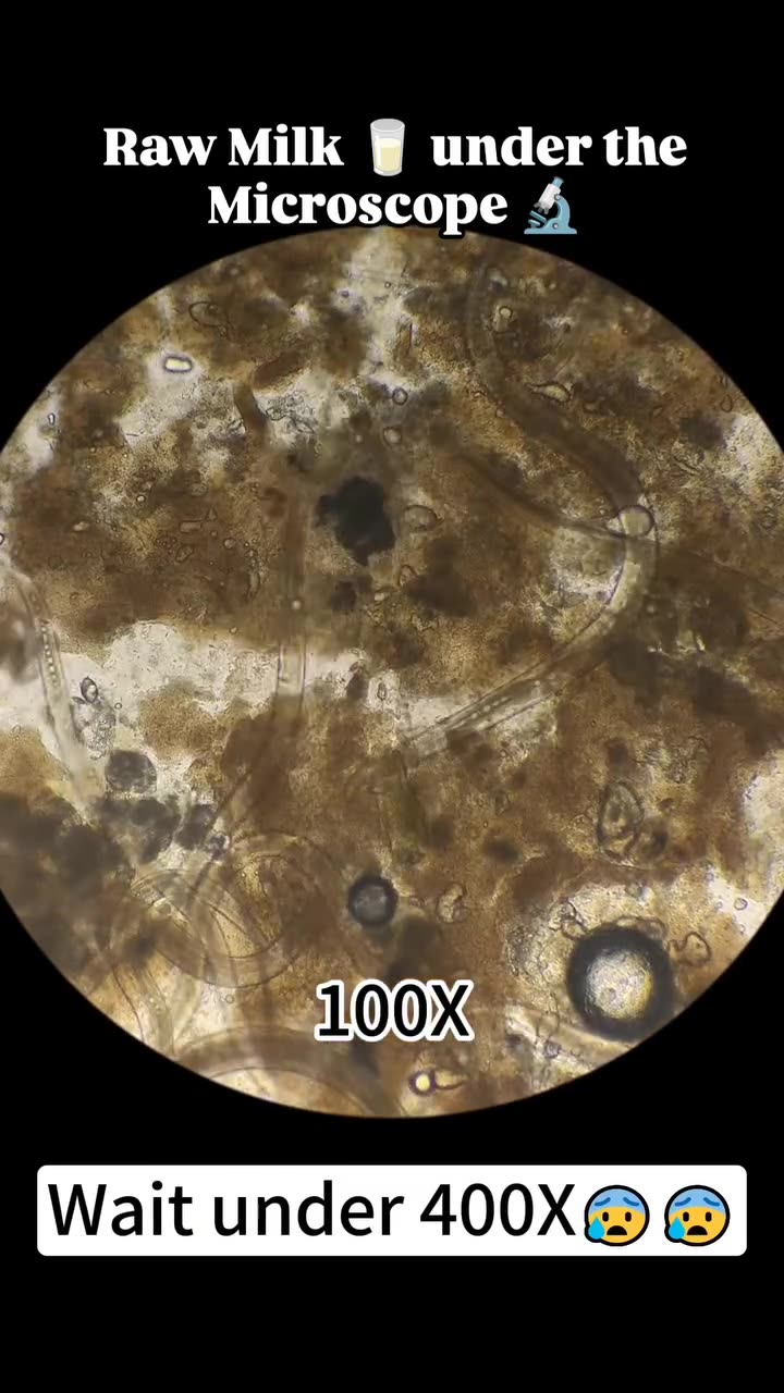 Ever wonder what happens to raw milk under microscope