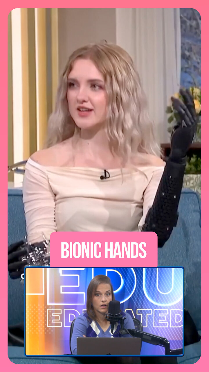 These Bionic Hands Are Incredible!