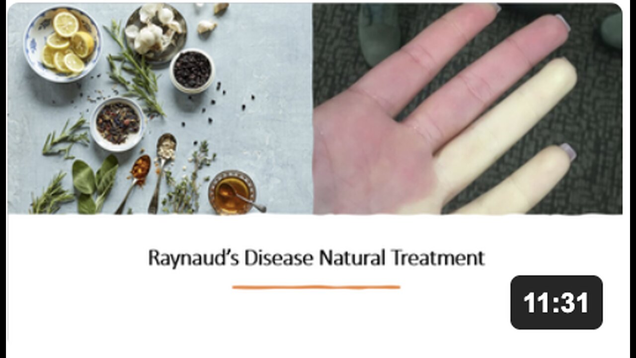 Raynaud's Disease Natural Treatment