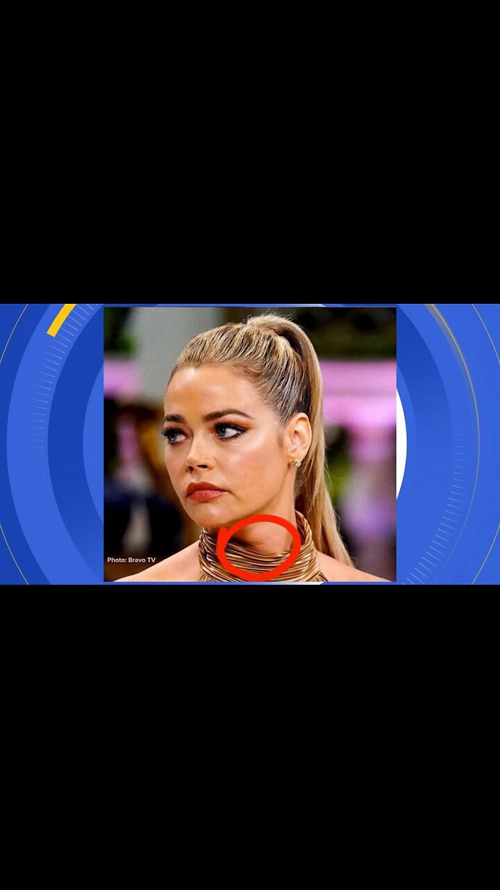 HASHIMOTO'S Disease and PARASITE Infection | Ward Dean MD