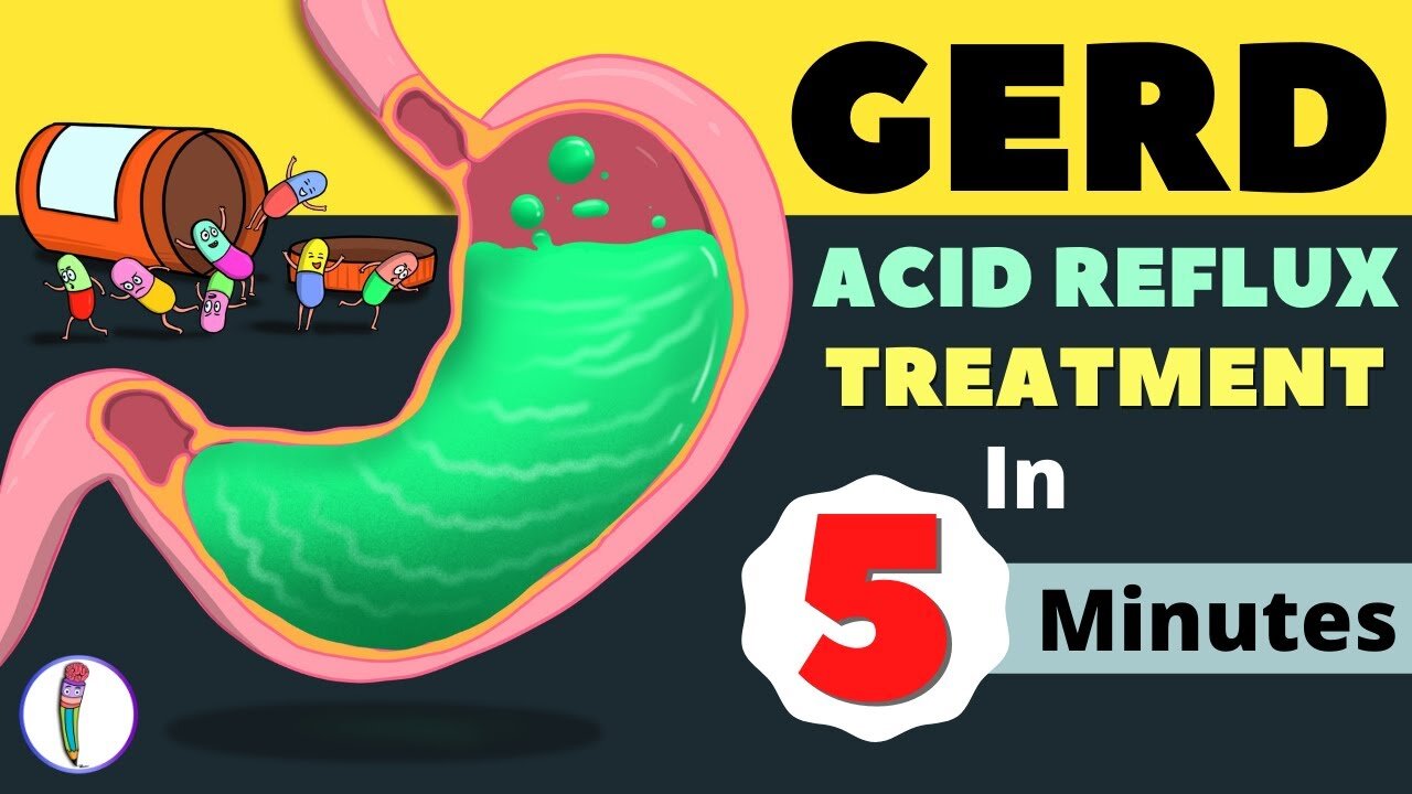 GERD Treatment | Acid Reflux Treatment | Heartburn Treatment - All You ...