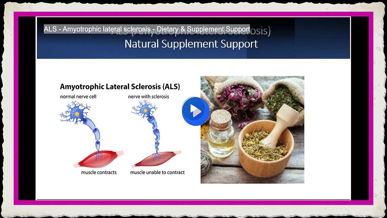ALS - Amyotrophic lateral sclerosis - Dietary Supplement Support