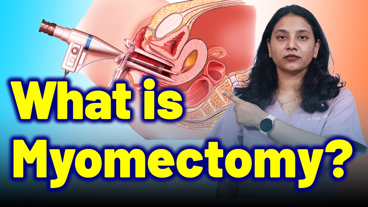 What Is Fibroid Surgery, Myomectomy Laparoscopy,Hysteroscopy,Abdominal ...