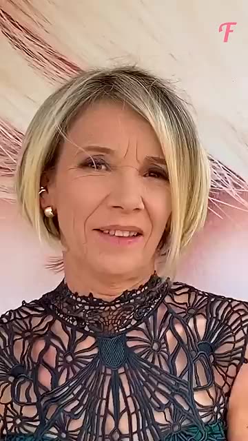 Viral Unrecognizable After Extreme Makeover Shorts