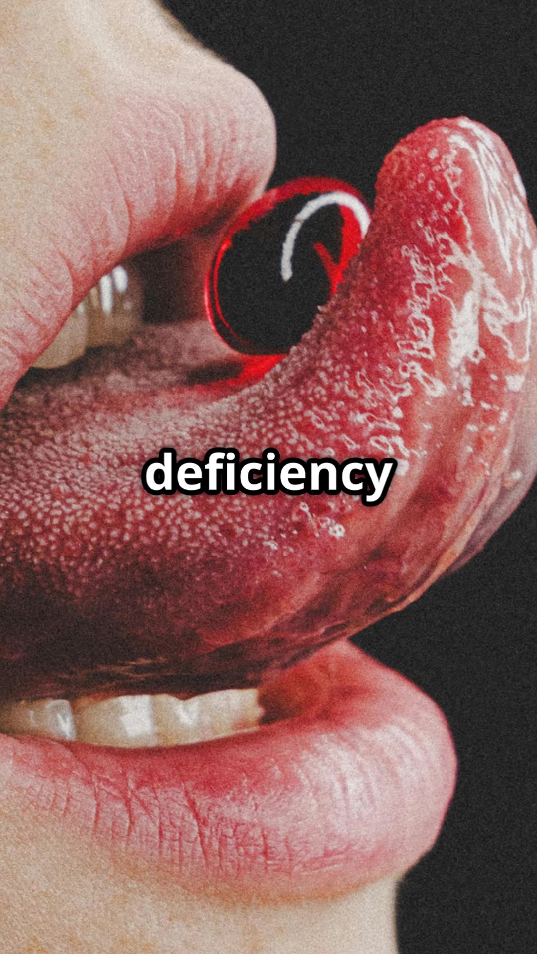 What Your Tongue Reveals About Your Health!