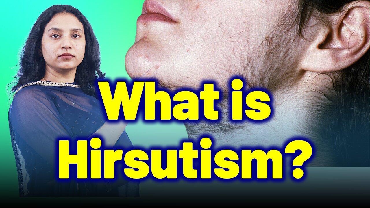 Unwanted Facial Hair in Women? Know About Hirsutism! | Treatment Cure Medicine | Gynaecology