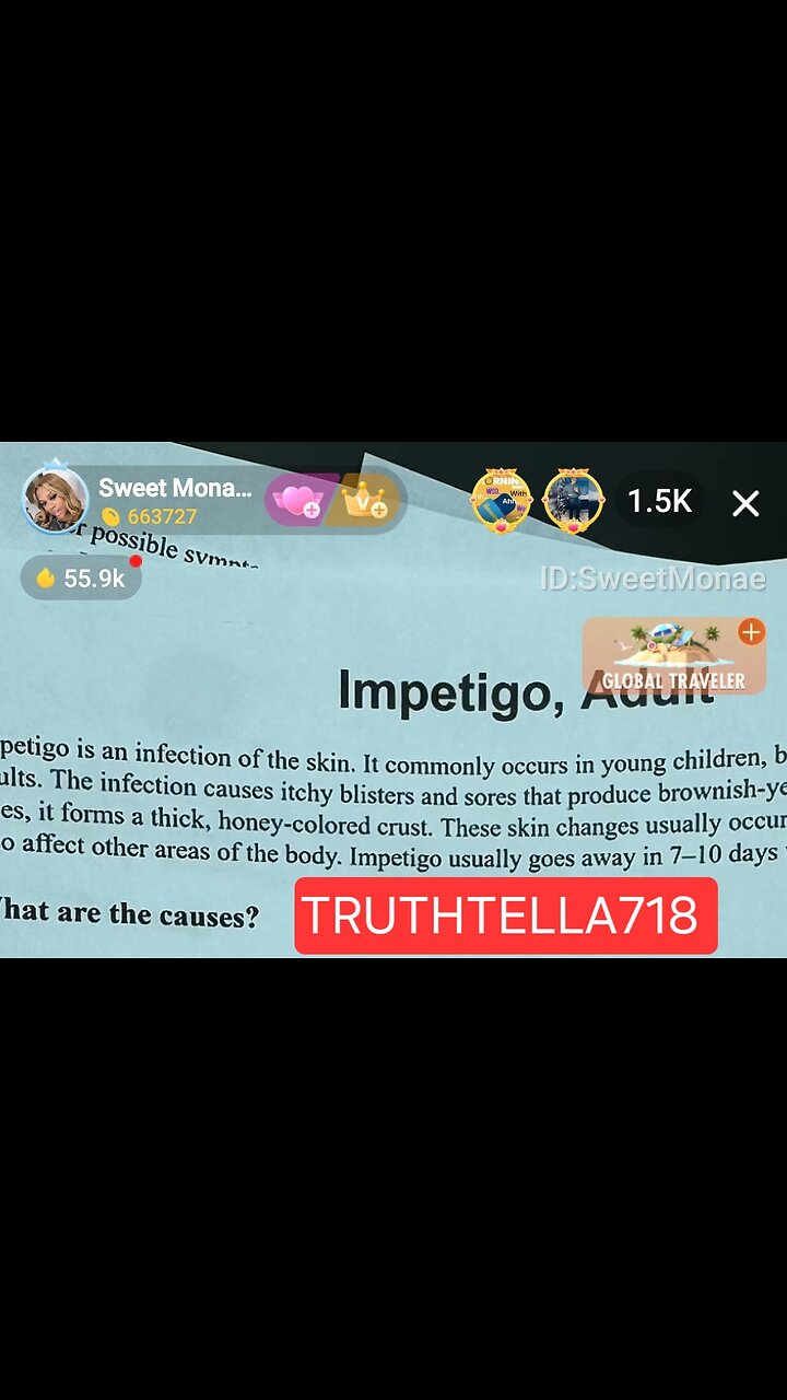 SWEET MONAE EXPLAINS THE INFECTION & BUMP BREAKOUT ON HER FACE