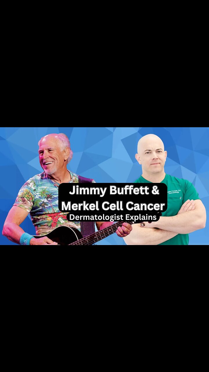 Jimmy Buffett died of Merkel Cell Carcinoma. What is that ...