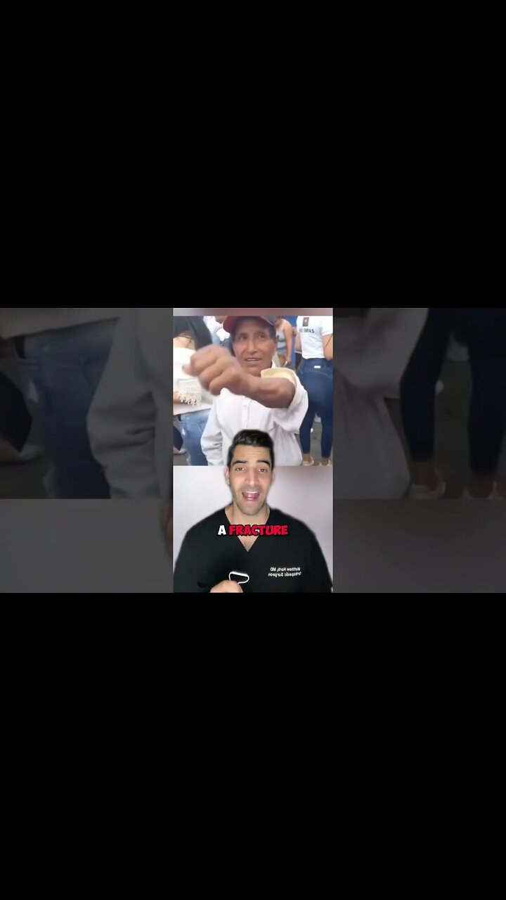 Bone that Never Heals