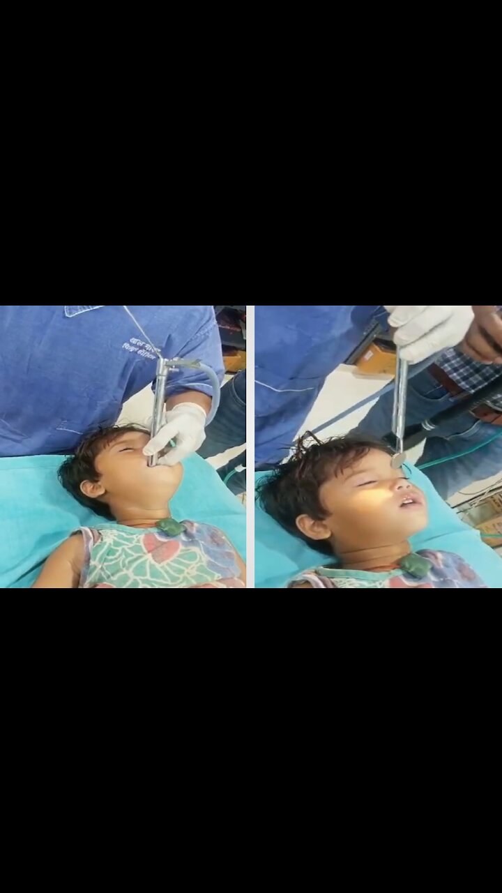 The Baby Was Swallowed Coin, Coin Stuck in Throat. The Doctors ...
