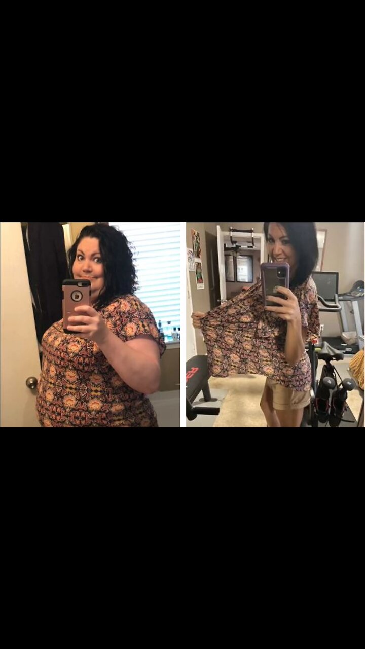 Weight Loss Transformation Before & After