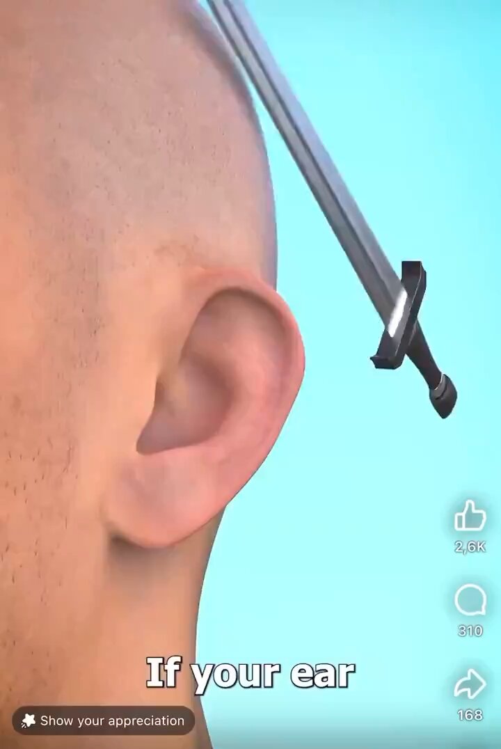 Ear accidentally get ripped off?