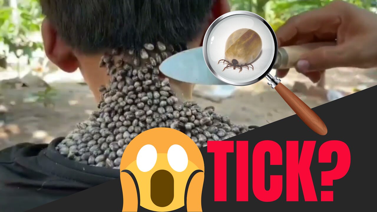 Dozens of Ticks in Children