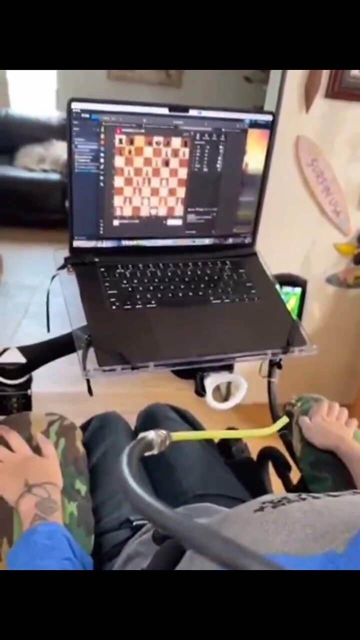 First Look At Elon Musk's Neuralink Shows Paralyzed Man Playing Chess ...