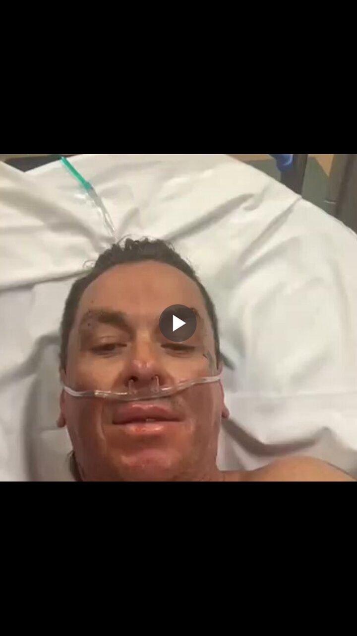 Slipknot’s Sid Wilson Hospitalized After Burn Injuries