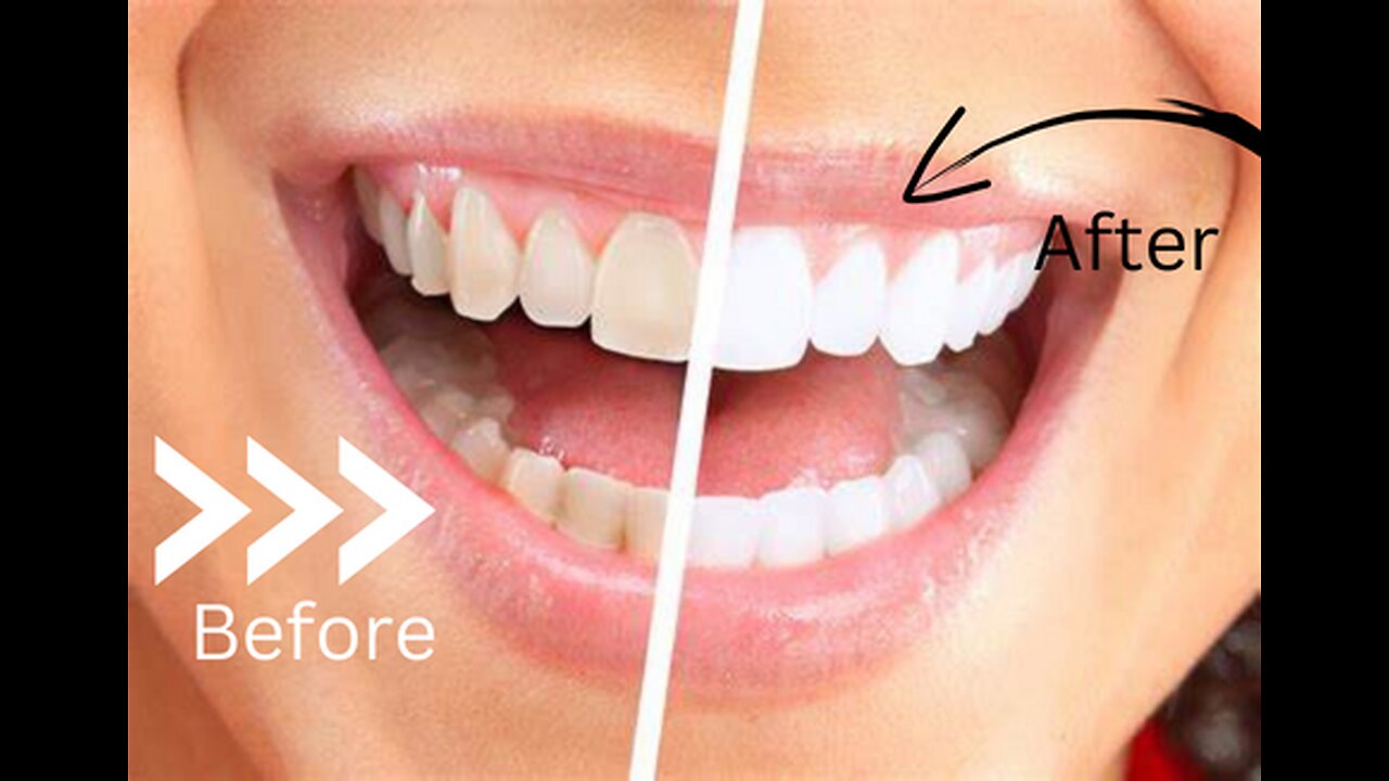 WHITEN YOUR TEETH WITH THESE 4 EASY STEPS!