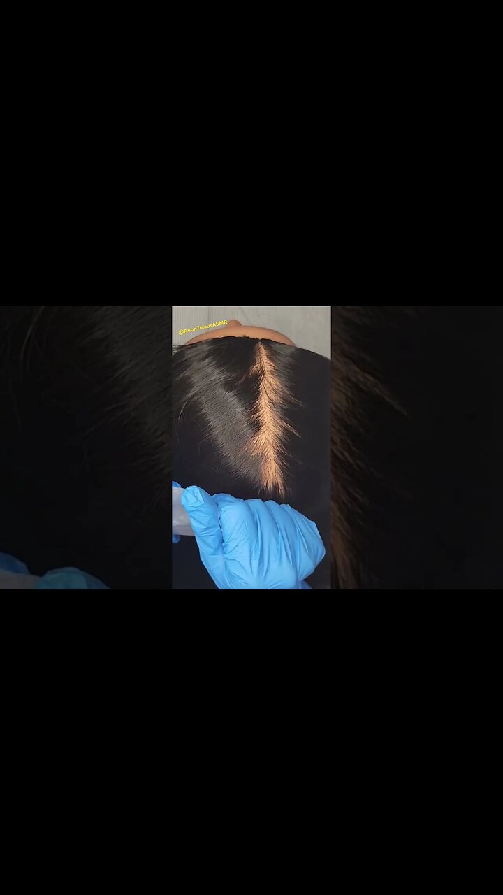 Scalp Check & Treatment ~ASMR No Talking #asmr #asmrsounds # ...