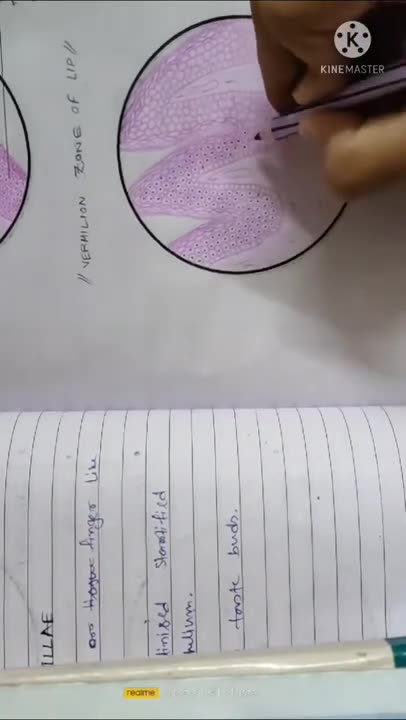 Drawing Histology of filiform papilla