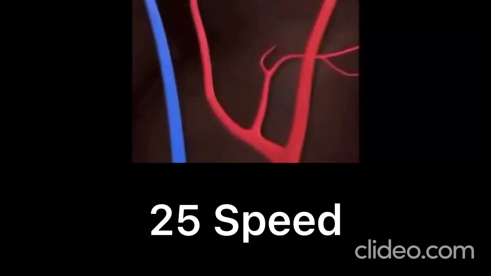 Brain Fart meme speed moded but reversed