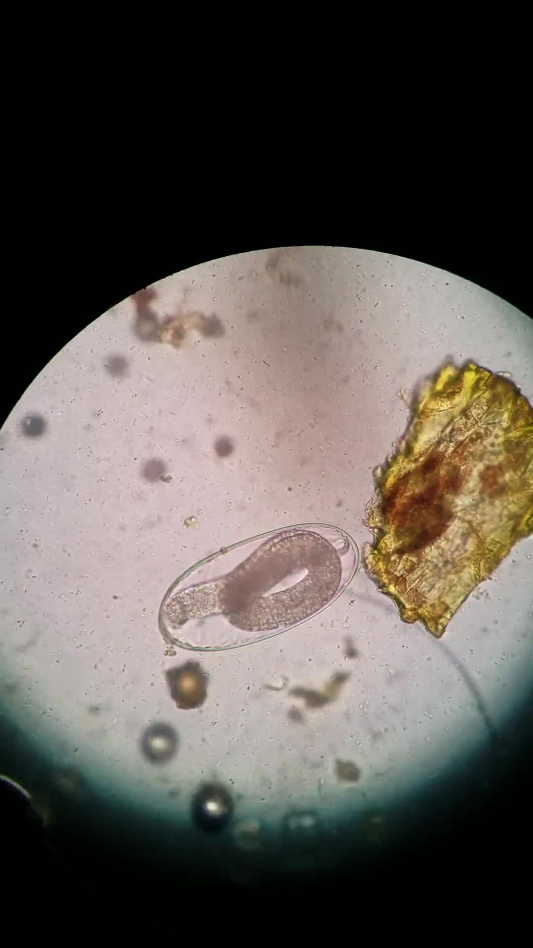 Nematodirus parasite ova