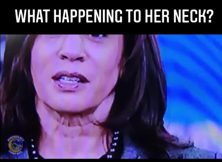 What Happened To Kamala's Neck?