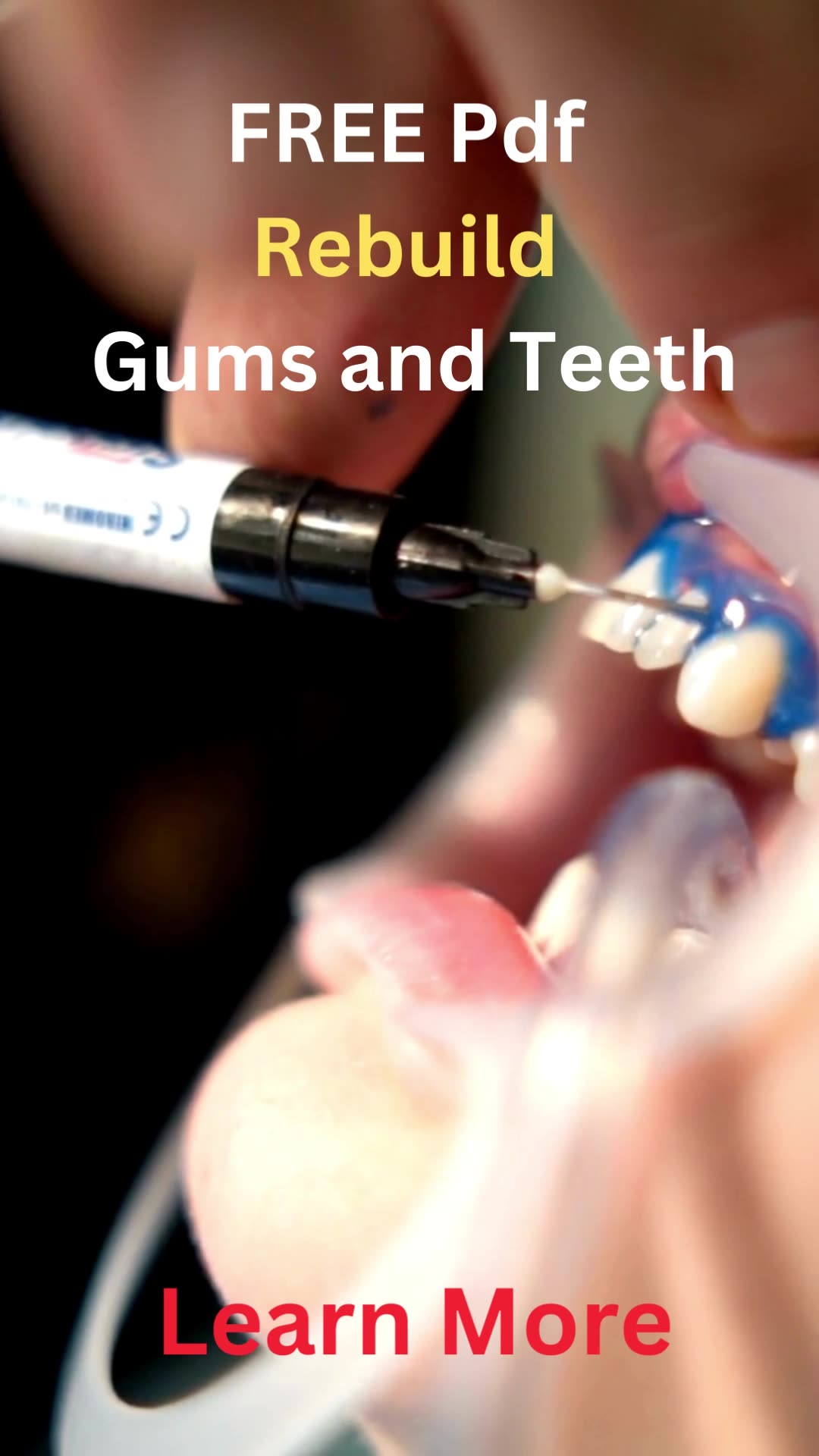 FREE Pdf Mineral to Rebuild Gums and Teeth #gums #Teeth #tooth #oral # ...