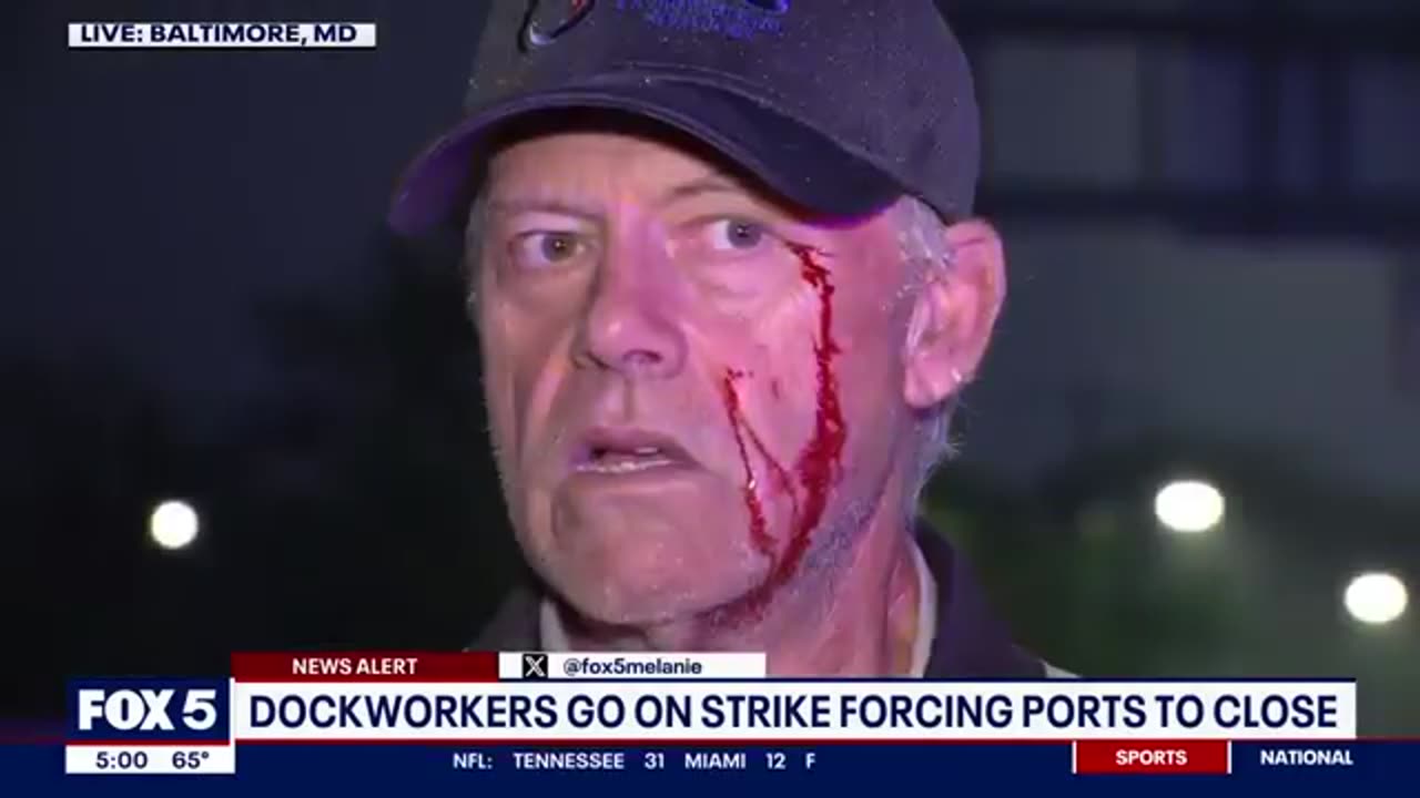 Port workers strike turns violent in Baltimore