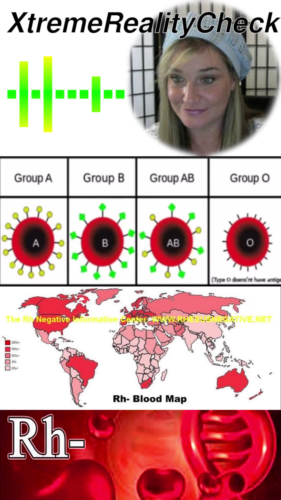 Blood types - what does it mean to be Rhesus negative?