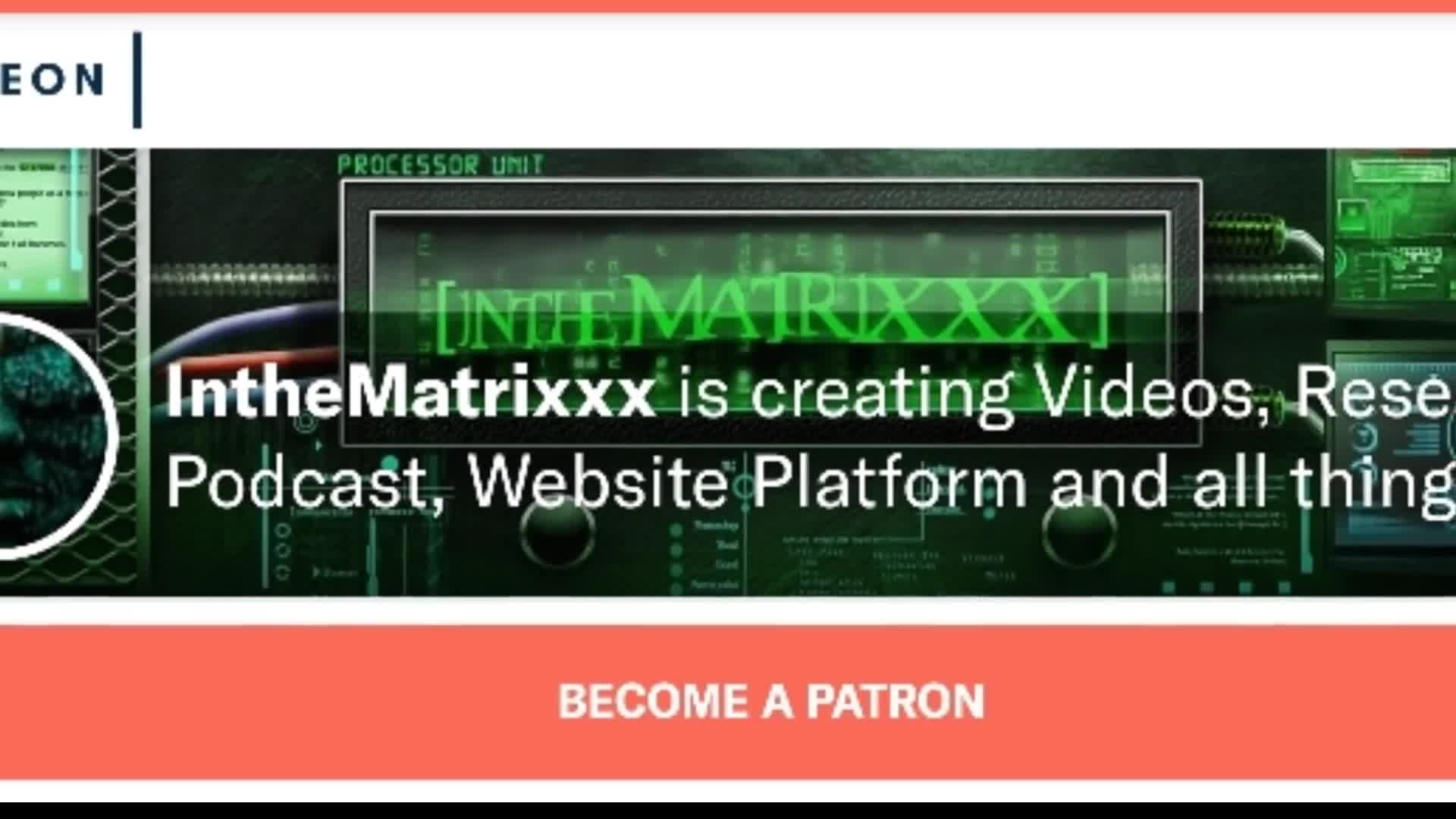 Matrixxx/Grooove - Severe Anon