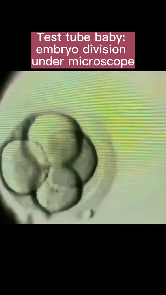 Test tube baby: embryo division under microscope