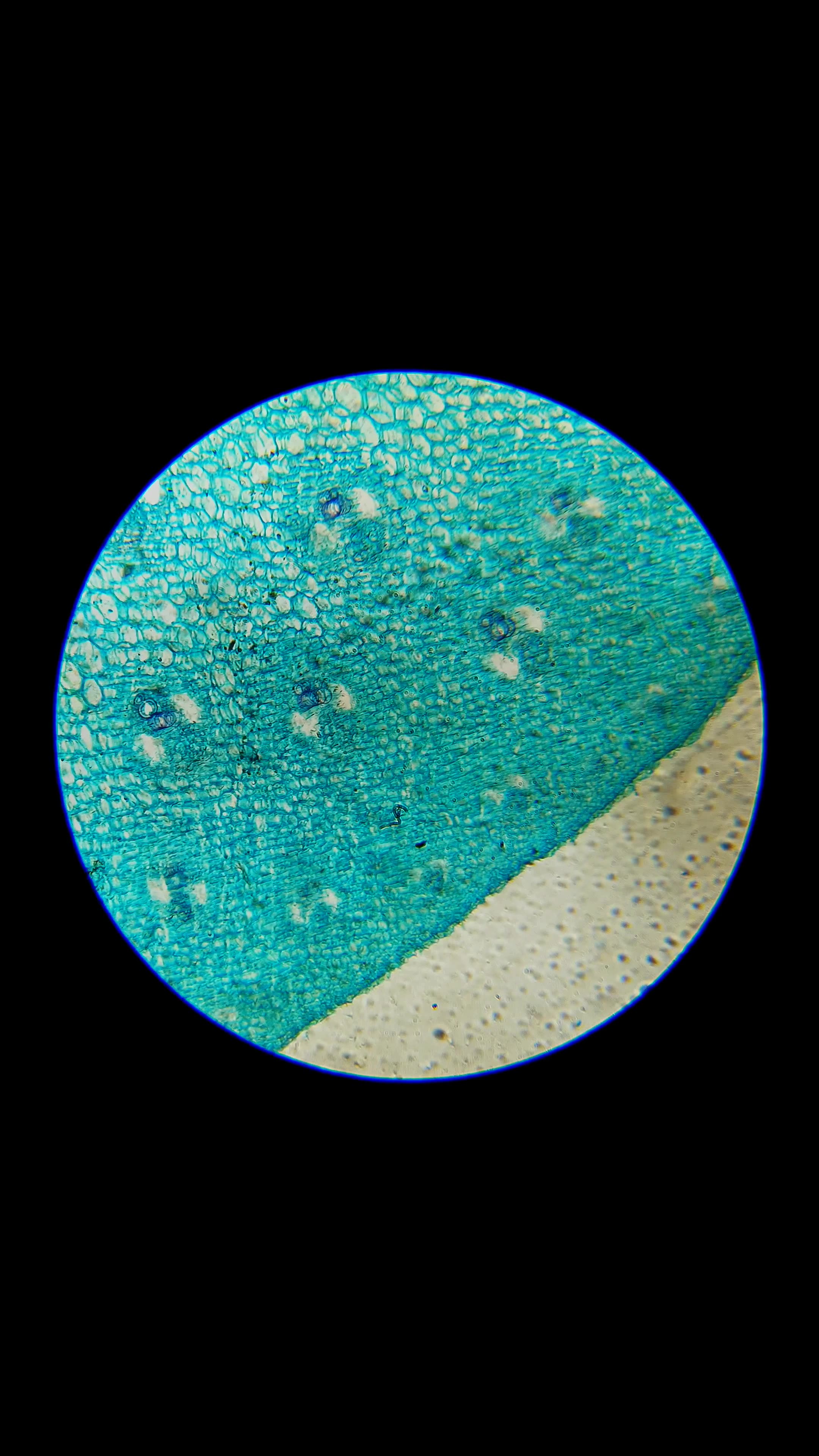 Monocot stem under the microscope || monocot stem