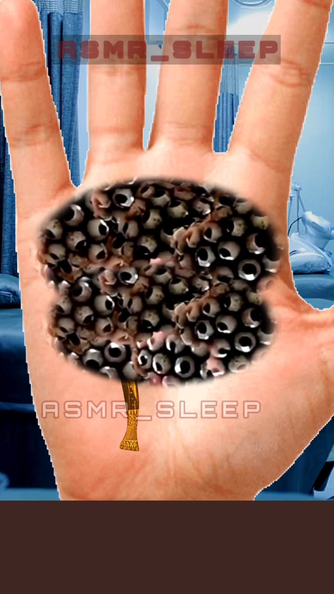 Calm Relaxing Hand infection 2D animation | Asmr #animation #asmr